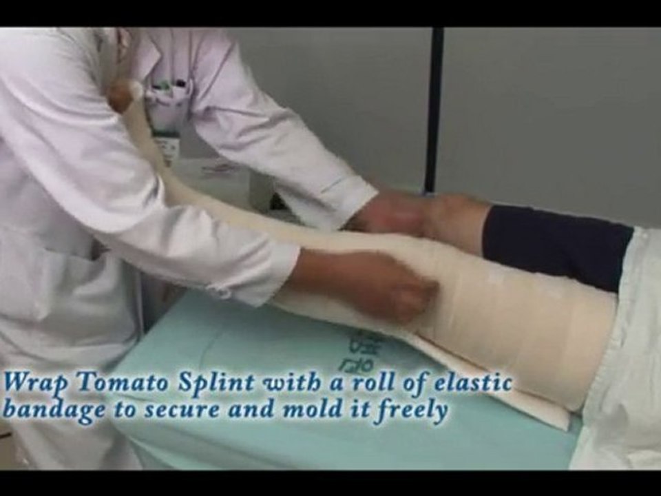 Tomato M&C Co. Ltd's leg splint - video Dailymotion