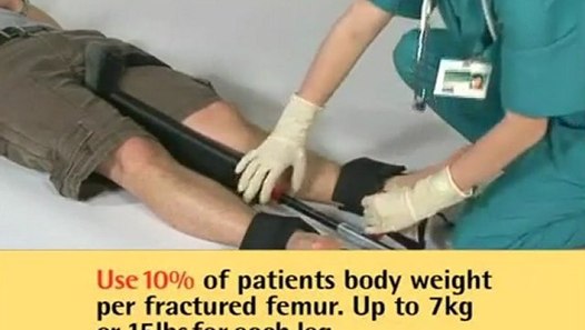 Sager Traction Splint Model SX404 from Penn Care EMS ... - video ...