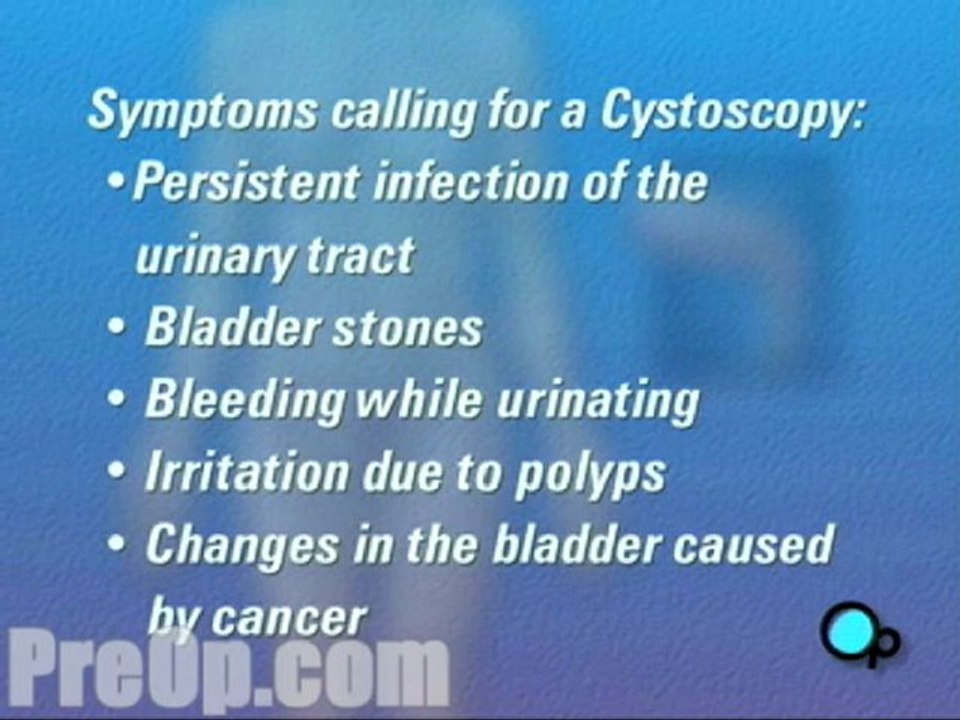 Cystoscopy Female - Body - video Dailymotion