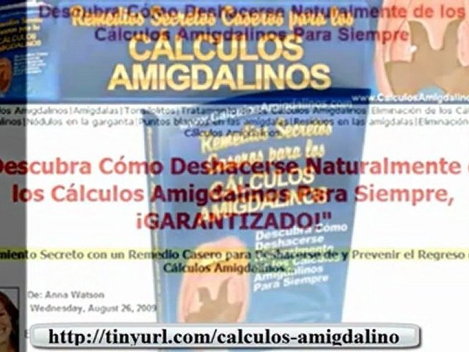 Caseum Amigdalar - Remedio Casero para las amigdalas - Curar las ...