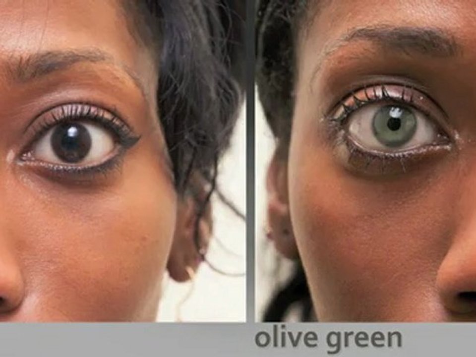 Change eye color permanently / brightocular/ eye color change surgery ...