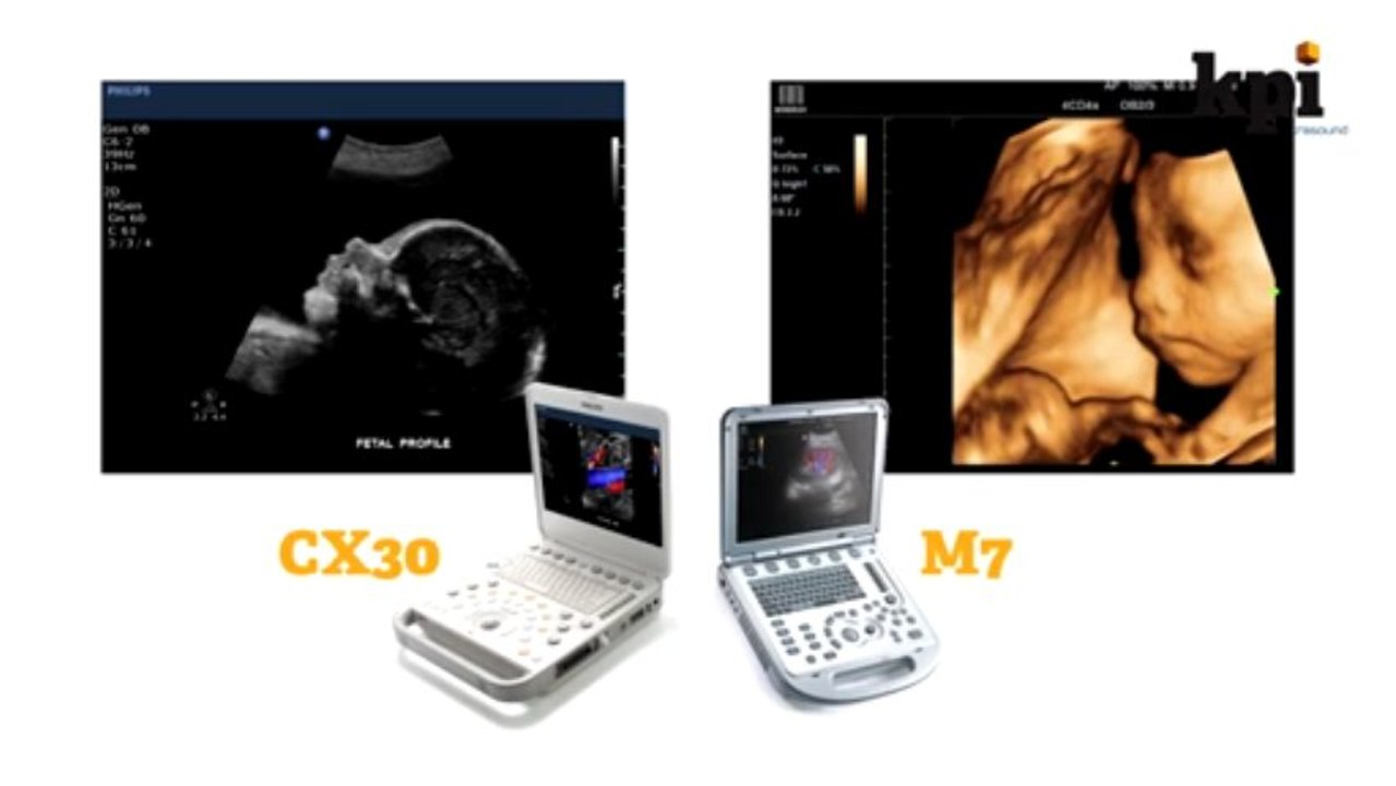 Philips CX30 portable ultrasound system review & comparison - video ...