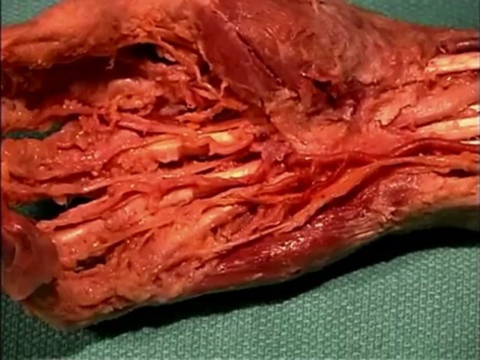 Human Anatomy Dissection 23 (part 1 of 2) Forearm and Hand - Vídeo ...