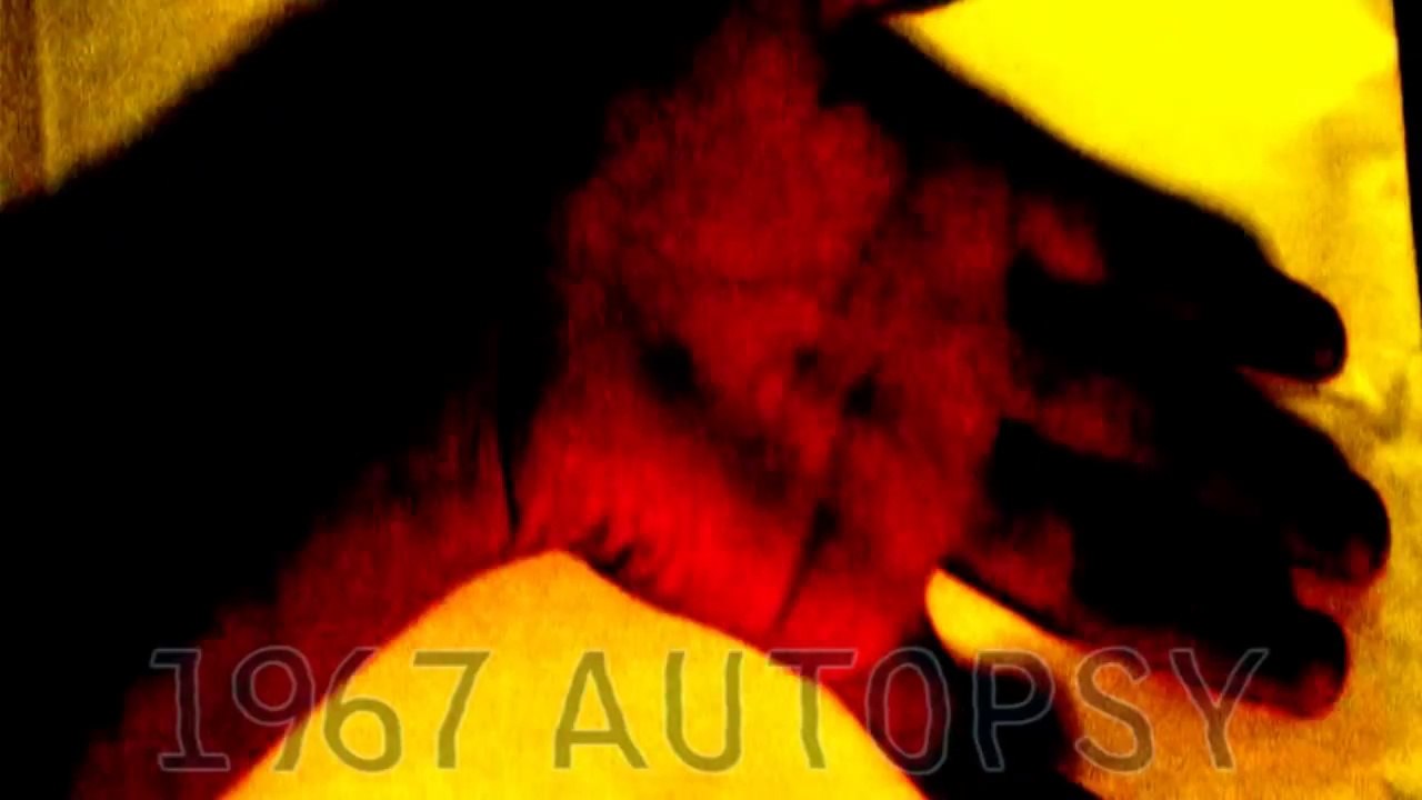 actual graphic autopsy footage from 1967 - video Dailymotion