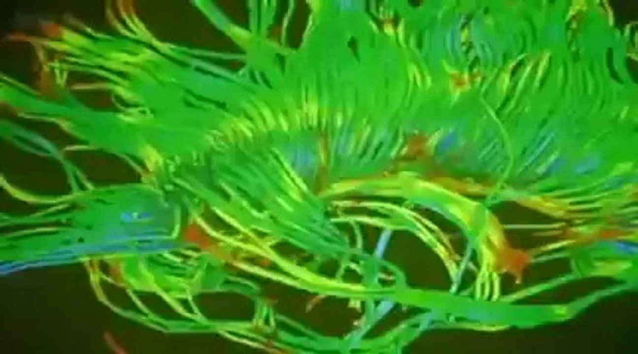 BBC Documentary - Horizon_ The Creative Brain How Insight Works - video ...