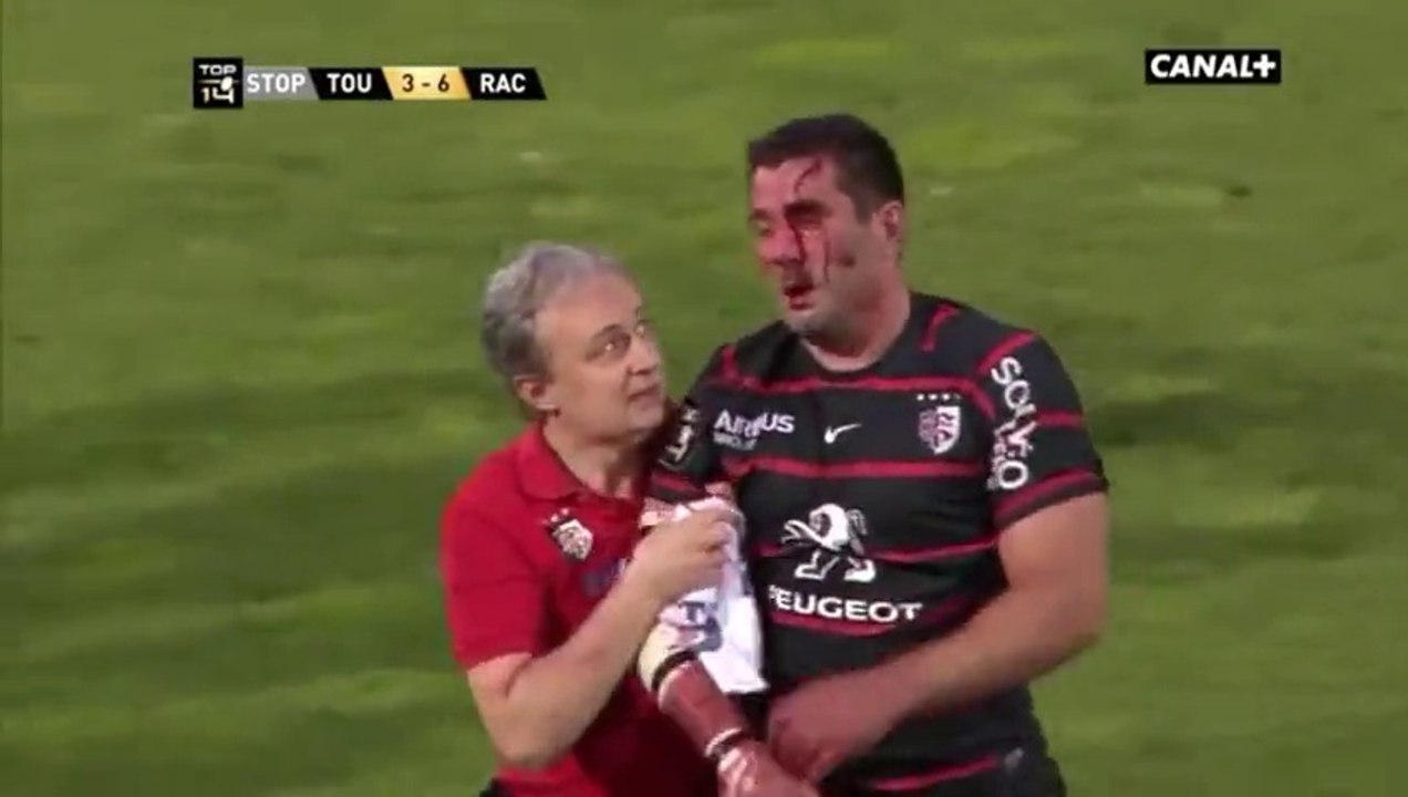 So impressive and bloody head injury during Rugby game... Florian Fritz ...