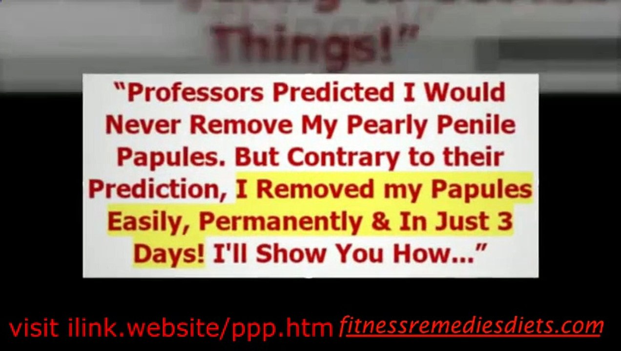 How To Get Rid Of Pearly Penile Papules Fast - video Dailymotion