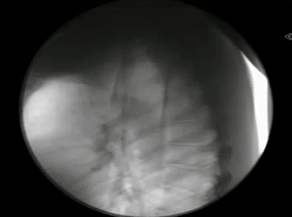 Moving X-ray INSIDE Sword Swallower Swallowing 7 swords on Stan Lee's ...