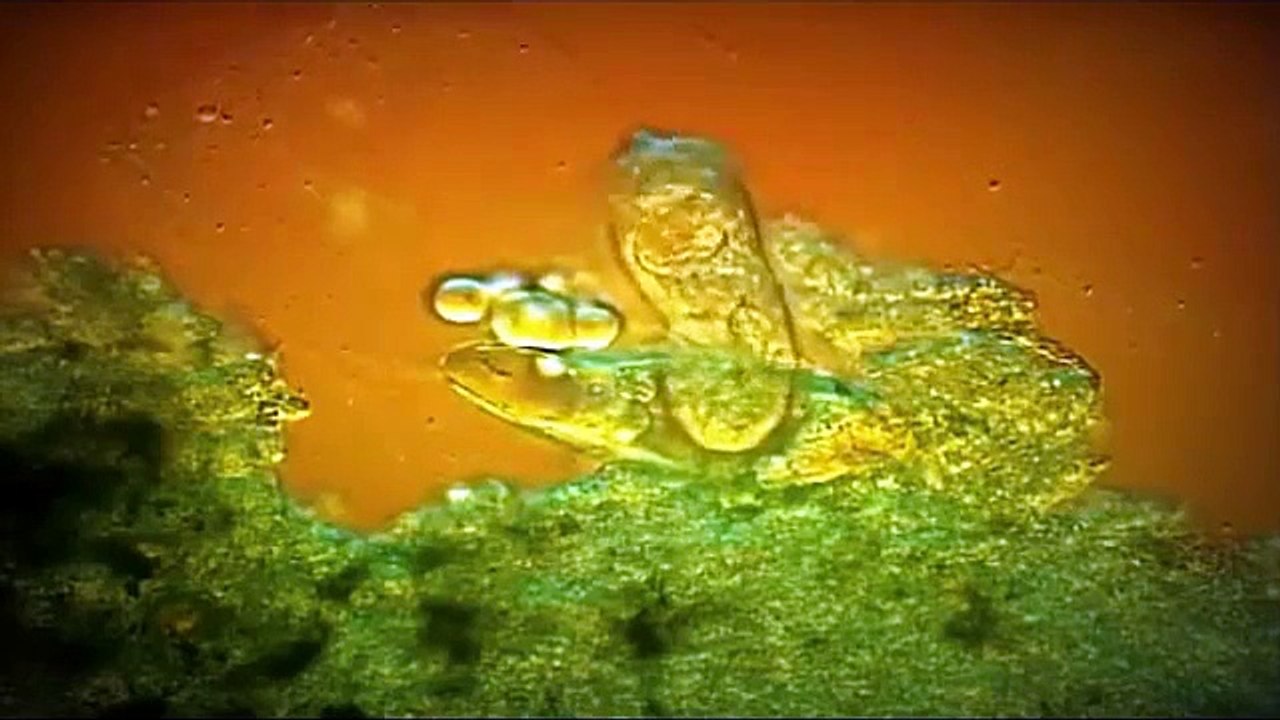 Parasites Eating Us Alive Documentary - video Dailymotion
