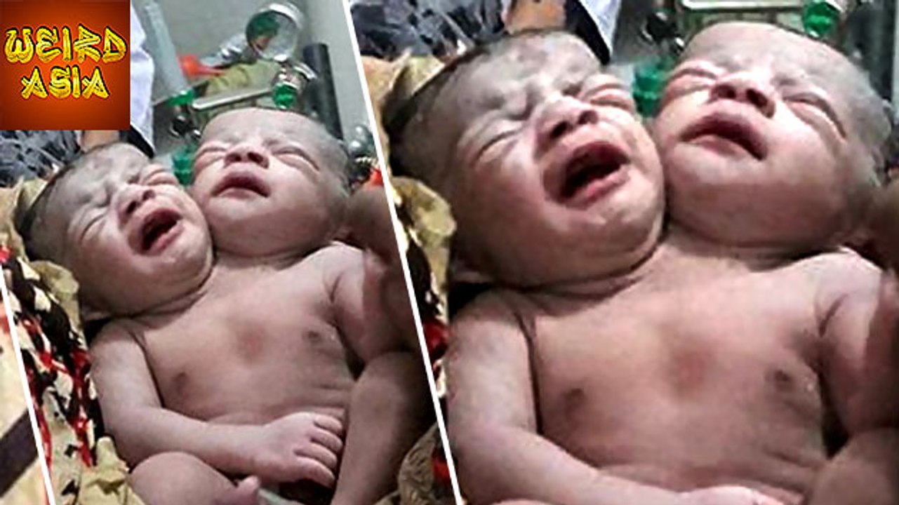 Baby Girl With TWO HEADS | SHOCKING - video Dailymotion
