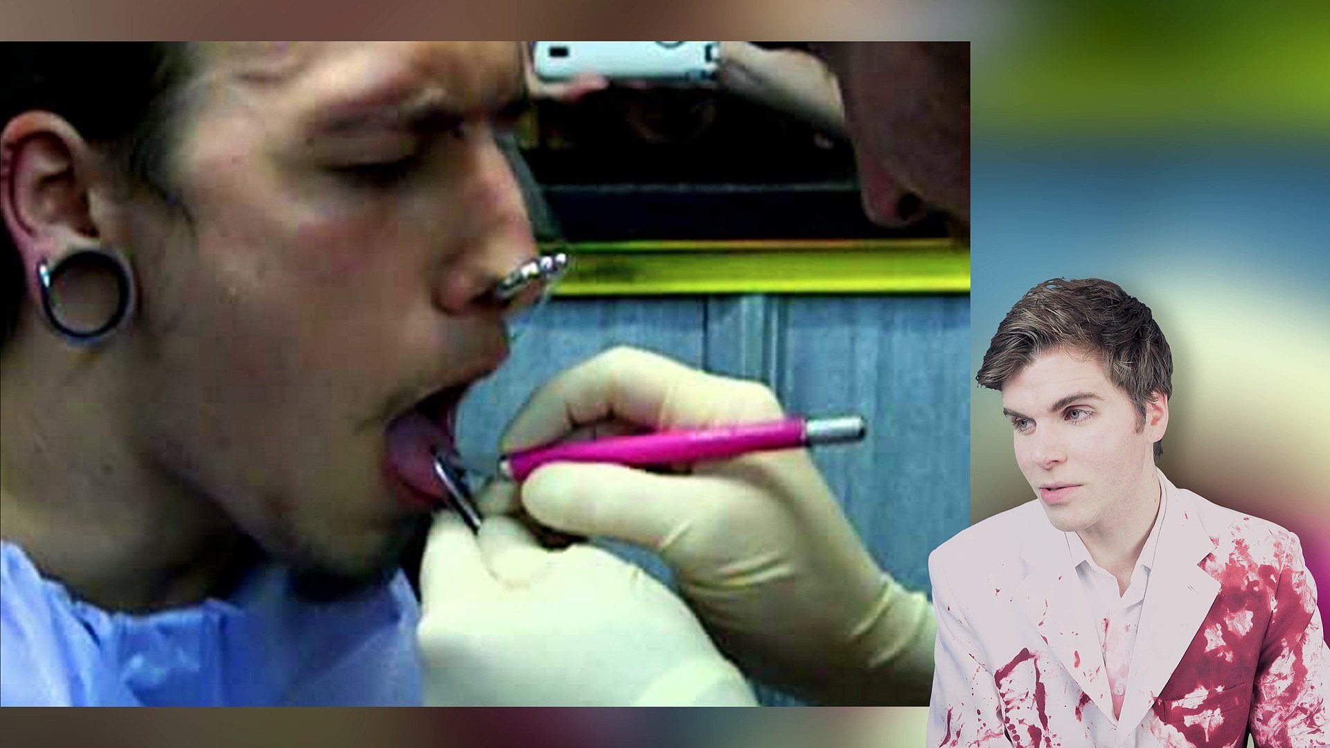 Tongue Splitting Gone Wrong