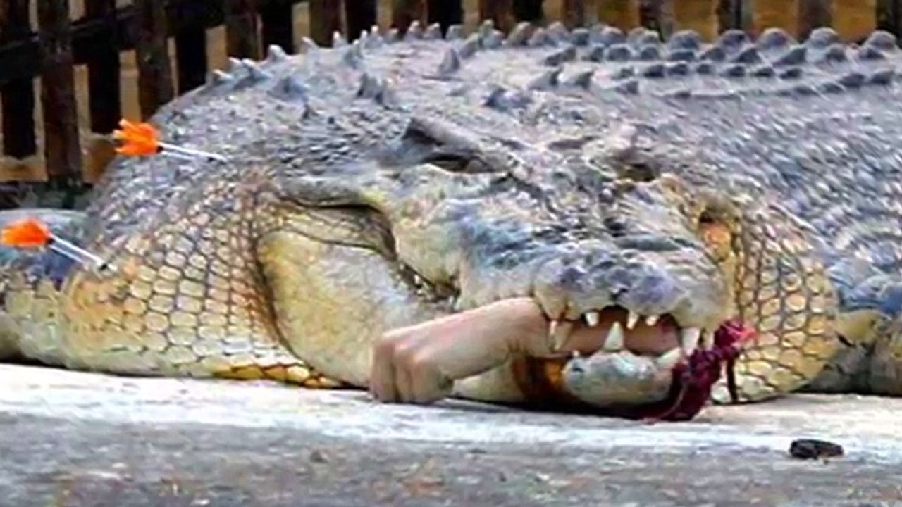 Crocodile Bites Hand Off! Doctors Reattach Appendage; Worst Animal Bite ...