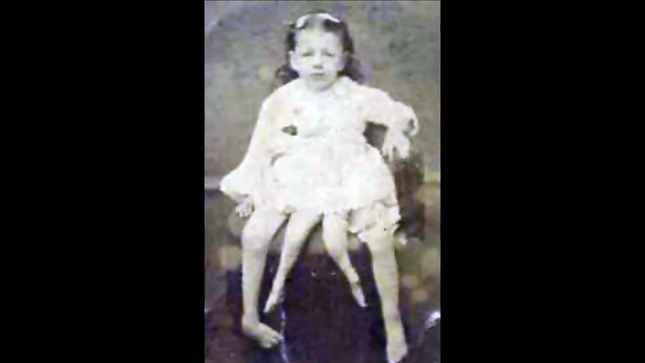 The four legged woman - video Dailymotion