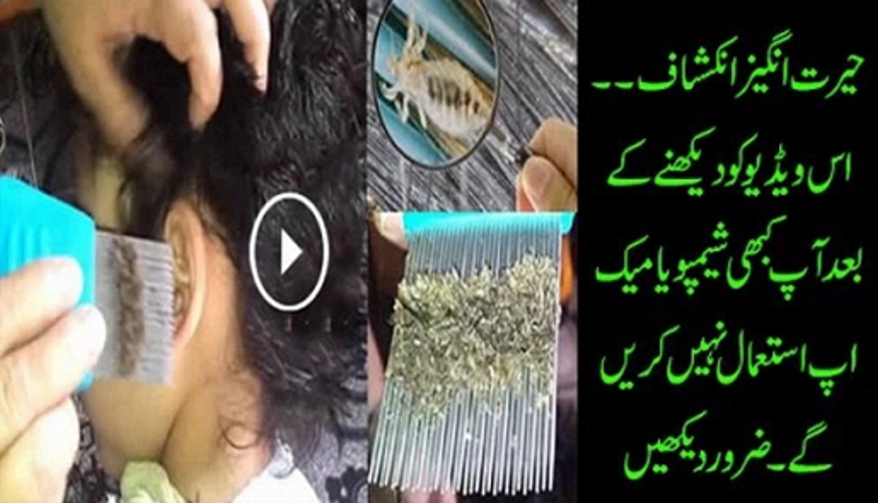 Horrible !!! Side effects of Make-up and Shampoos - video Dailymotion