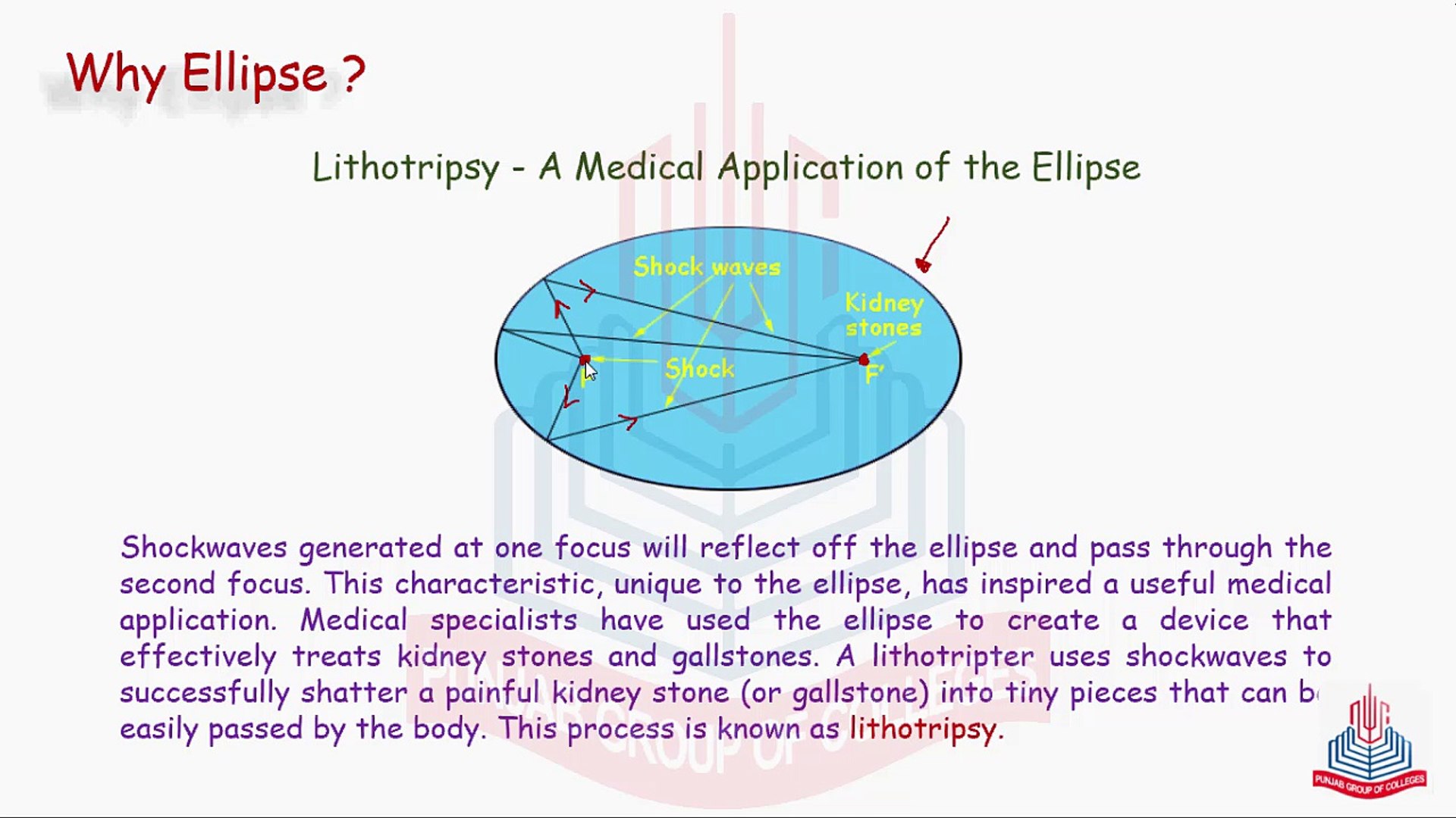Lithotripter Ellipse