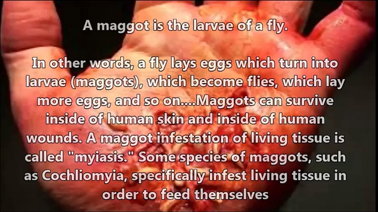 PARASIT BOTFLY MAGGOT LIVING UNDER HUMAN SKIN - video Dailymotion