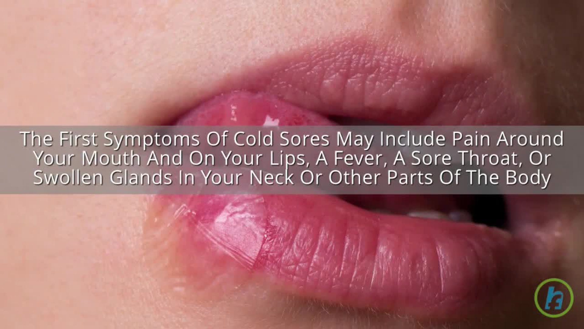 Cold Sore On Lip Swollen