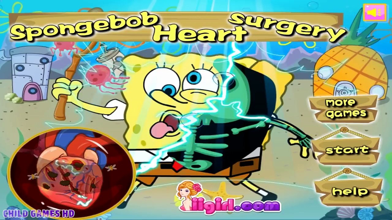 SpongeBob SquarePants Surgery - Heart, Stomach, Esophagus & Gastric ...