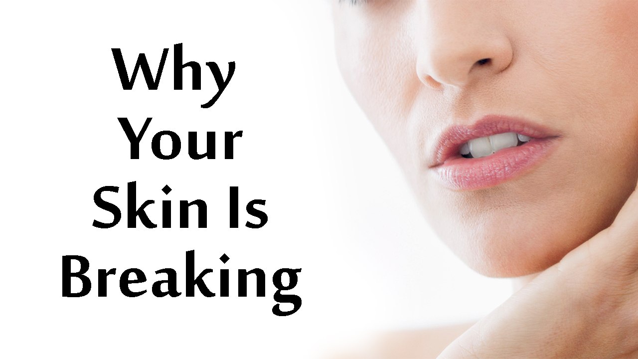 10 Surprising Reasons Why Your Skin Is Breaking Out | Boldsky - video ...