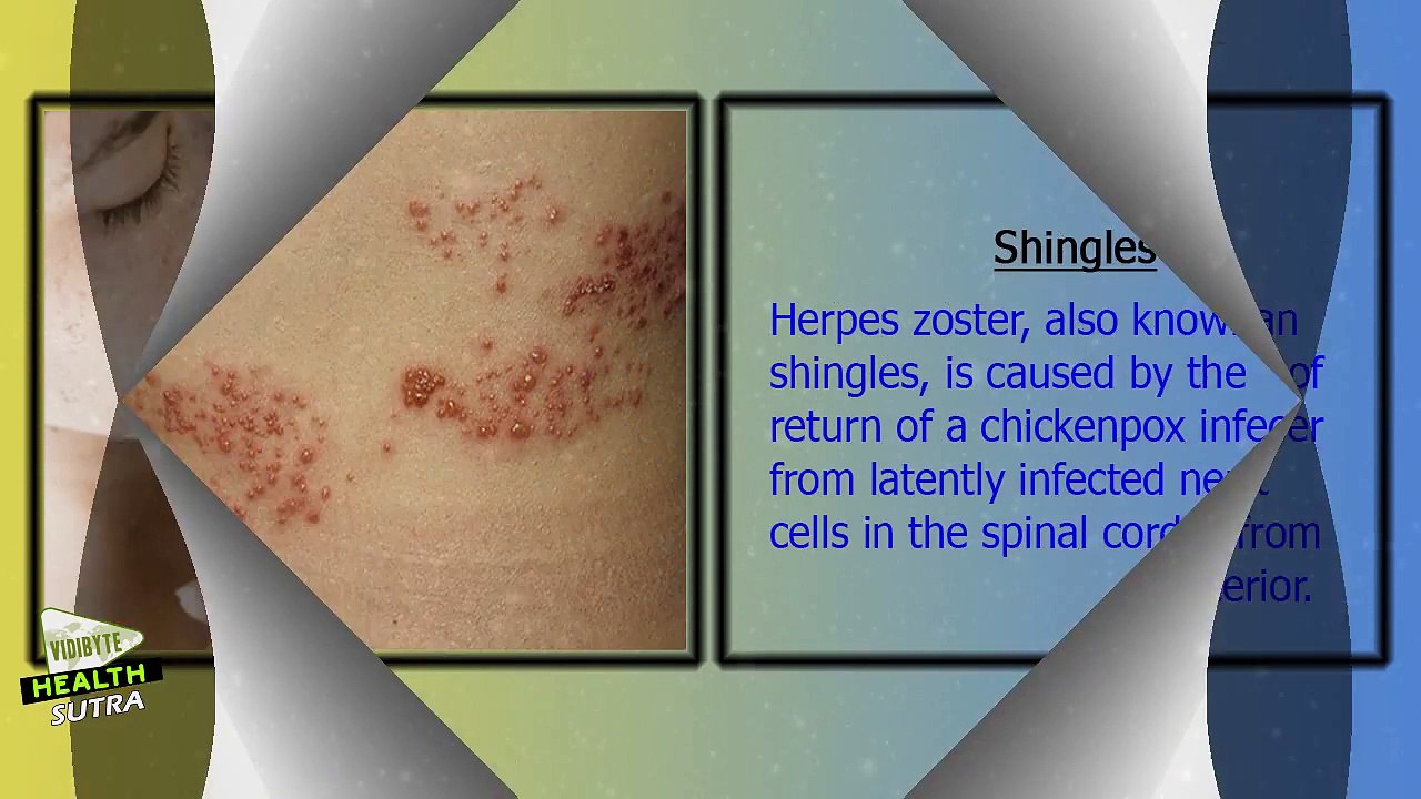 Common Adult Skin Problems in general view - video Dailymotion