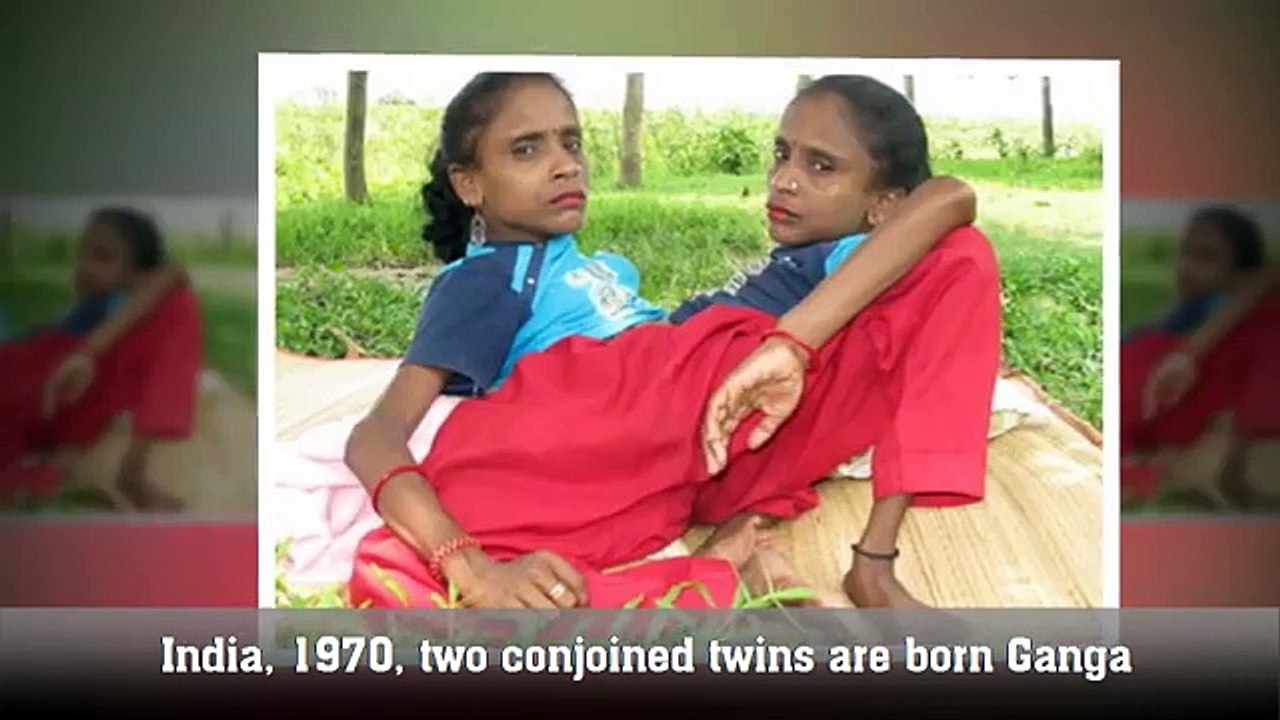 Top 15 People Who Were Born With Extra Body Parts - video Dailymotion