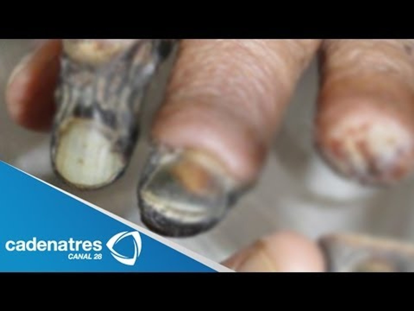 La Nueva Droga Cocodrilo