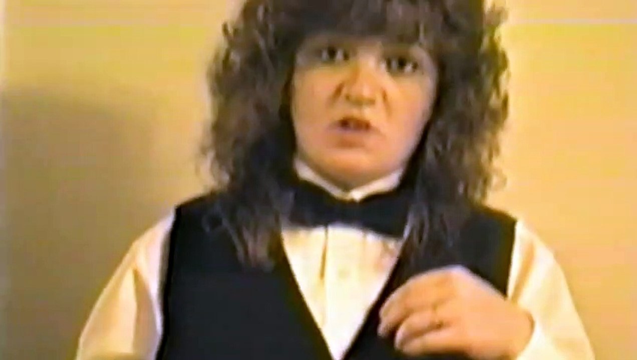 The Girl With Half a Face Parry-Romberg Syndrome (Medical Documentary ...