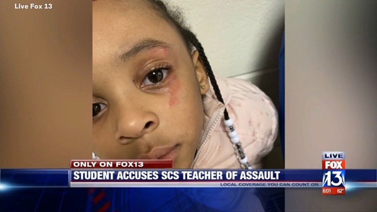 'Tattletaling' Memphis Kindergarten Girl Smacked In Face With Ruler ...