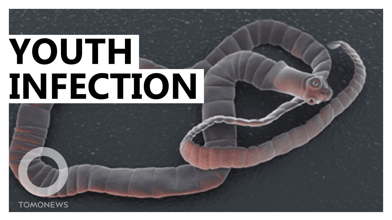 Tapeworms in Ants Keep Hosts Young for the Strangest Reason - video ...