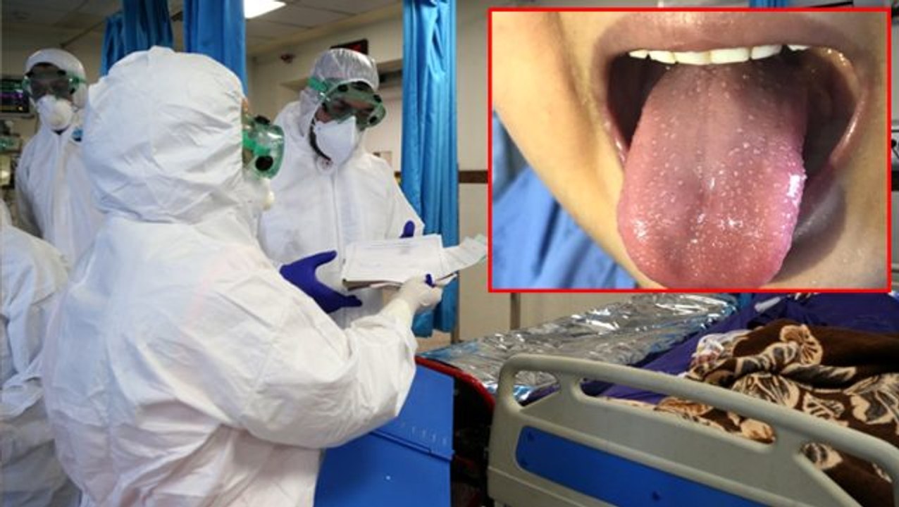 Korona sonrası çocuklar arasında iltihaplanma vakaları uzmanları ...