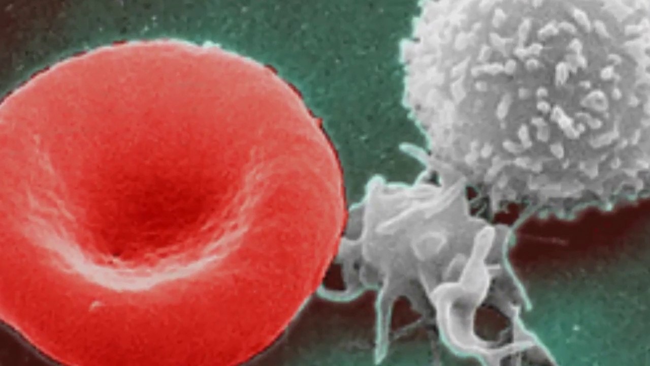what hiv does to your body - video Dailymotion