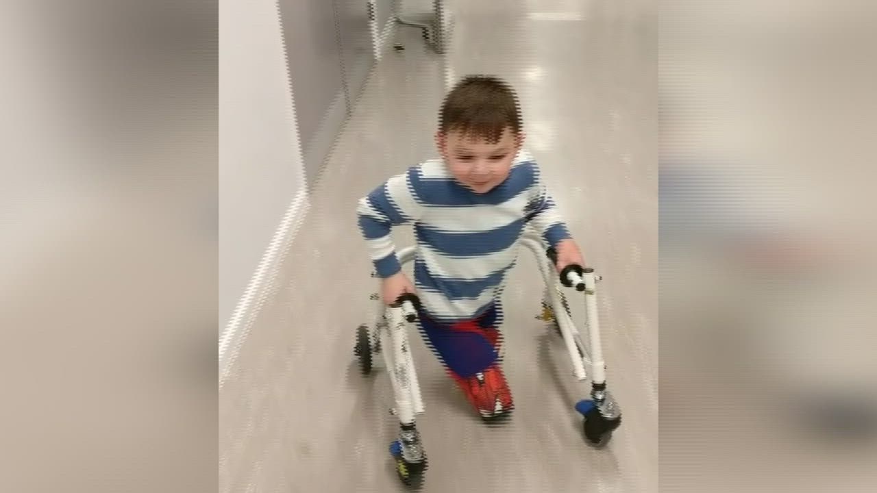 Baby Tony tries out new prosthetics