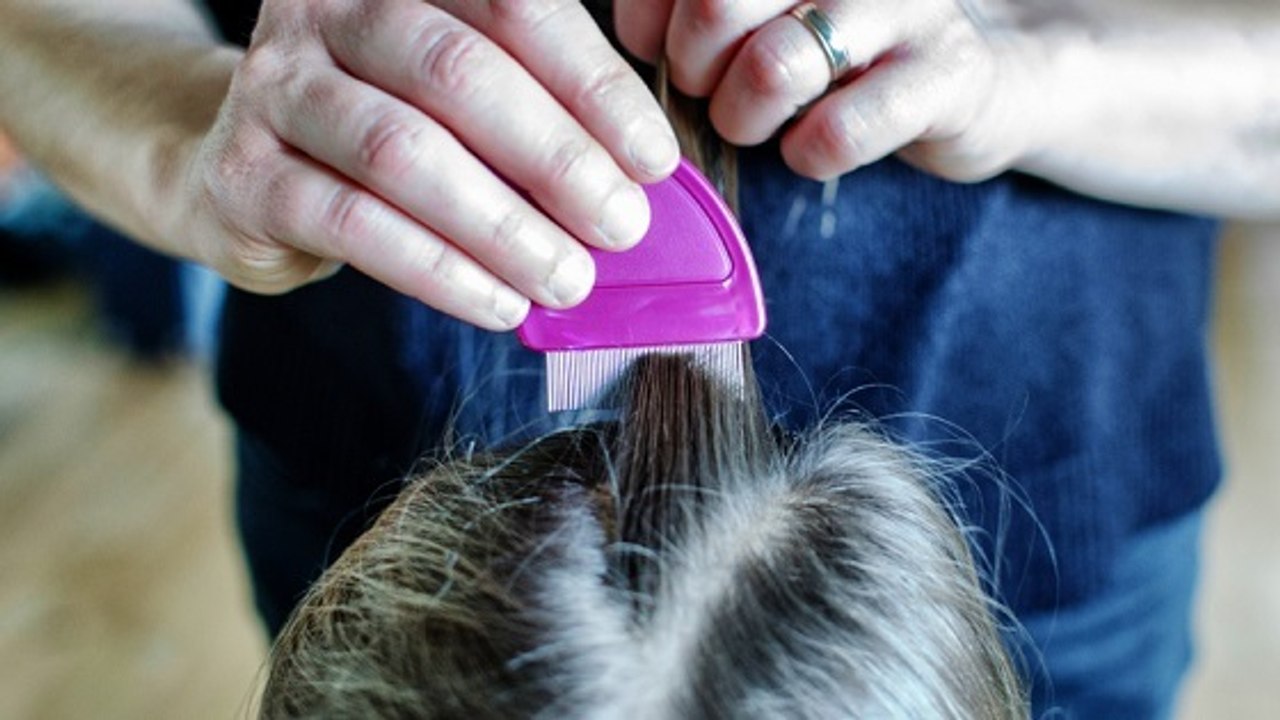 Poux : comment les reconnaitre et comment s'en débarrasser ? - Vidéo ...