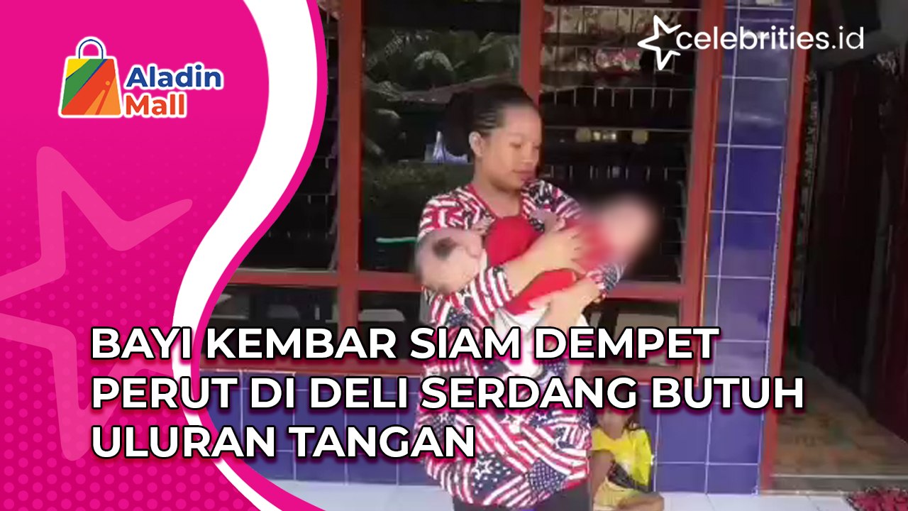 Bayi Kembar Siam Dempet Perut di Deli Serdang Butuh Uluran Tangan ...