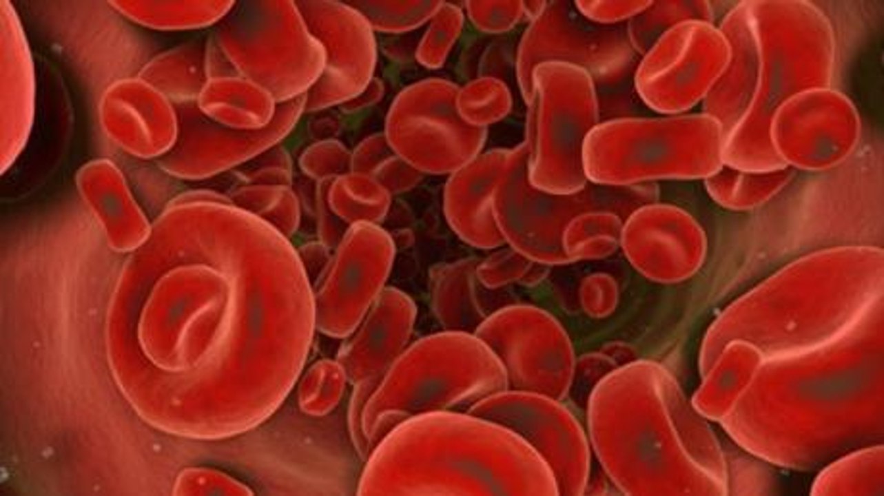 Septicémie : définition, symptômes, traitement, qu’est-ce que le sepsis ...