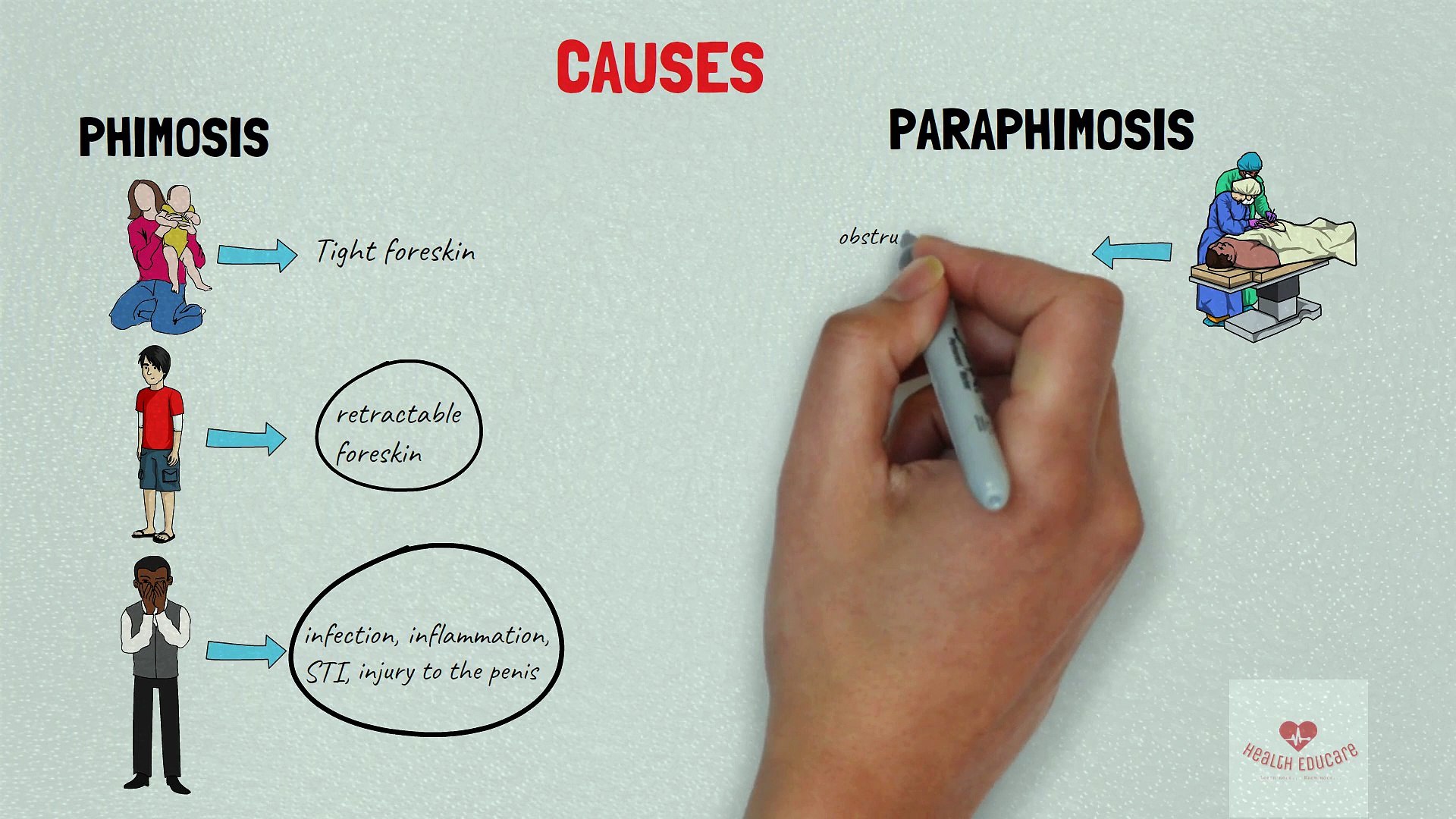 Phimosis And Paraphimosis