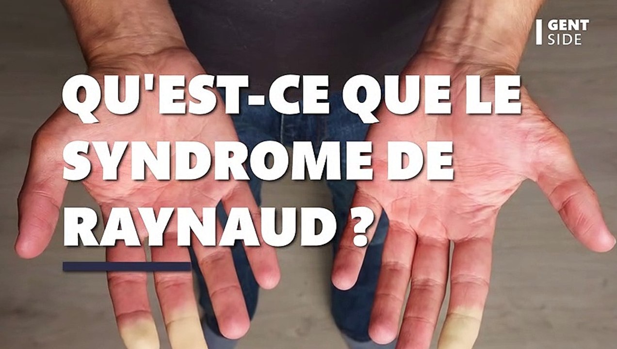 Syndrome de Raynaud : traitement, causes, diagnostic, de quoi s'agit-il ...