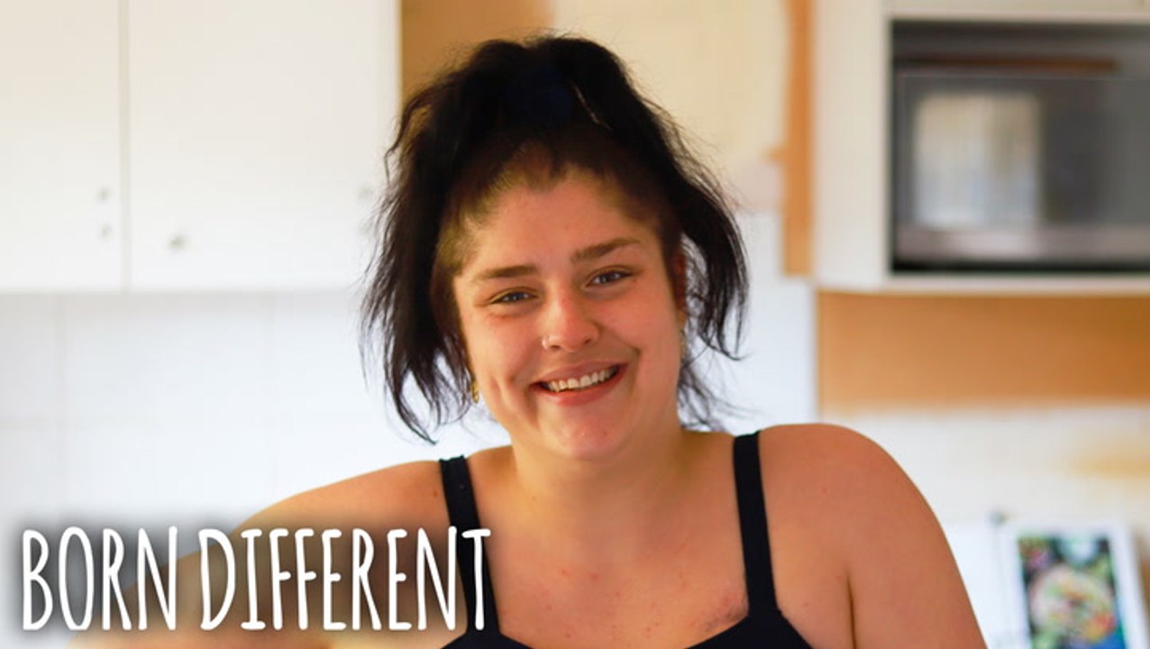 How I Cope With Tourette's Syndrome | BORN DIFFERENT - video Dailymotion