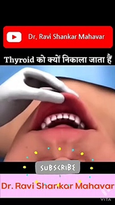 Thyroidectomy Surgery #shorts #viral @Dr. Ravi Shankar Mahavar - video ...