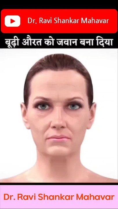 facelift surgery #women #shorts #viral @Dr. Ravi Shankar Mahavar ...