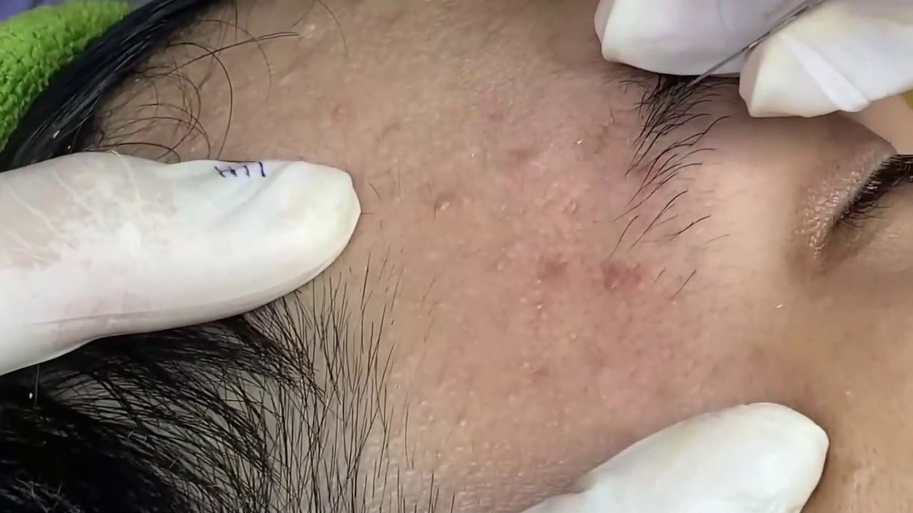 A Very Good Day with LIH Videos #001 - video Dailymotion