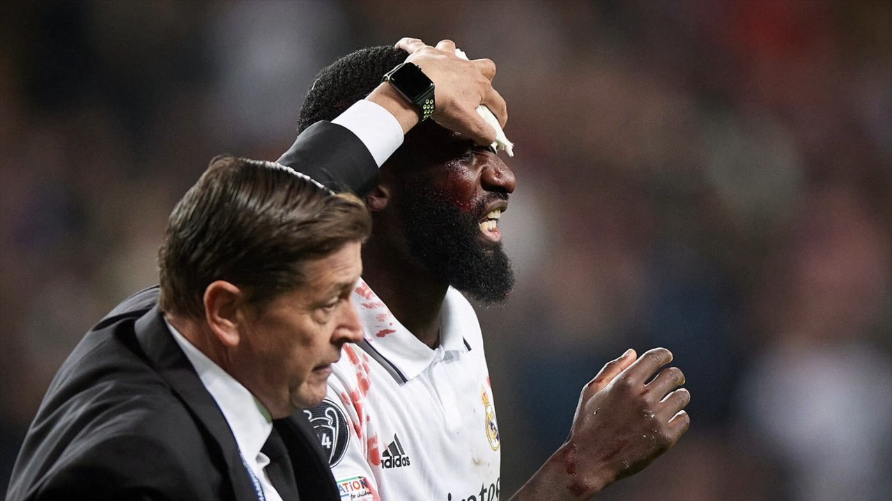 Real-Held Rüdiger kann zugeschwollenes Auge nicht öffnen - video ...