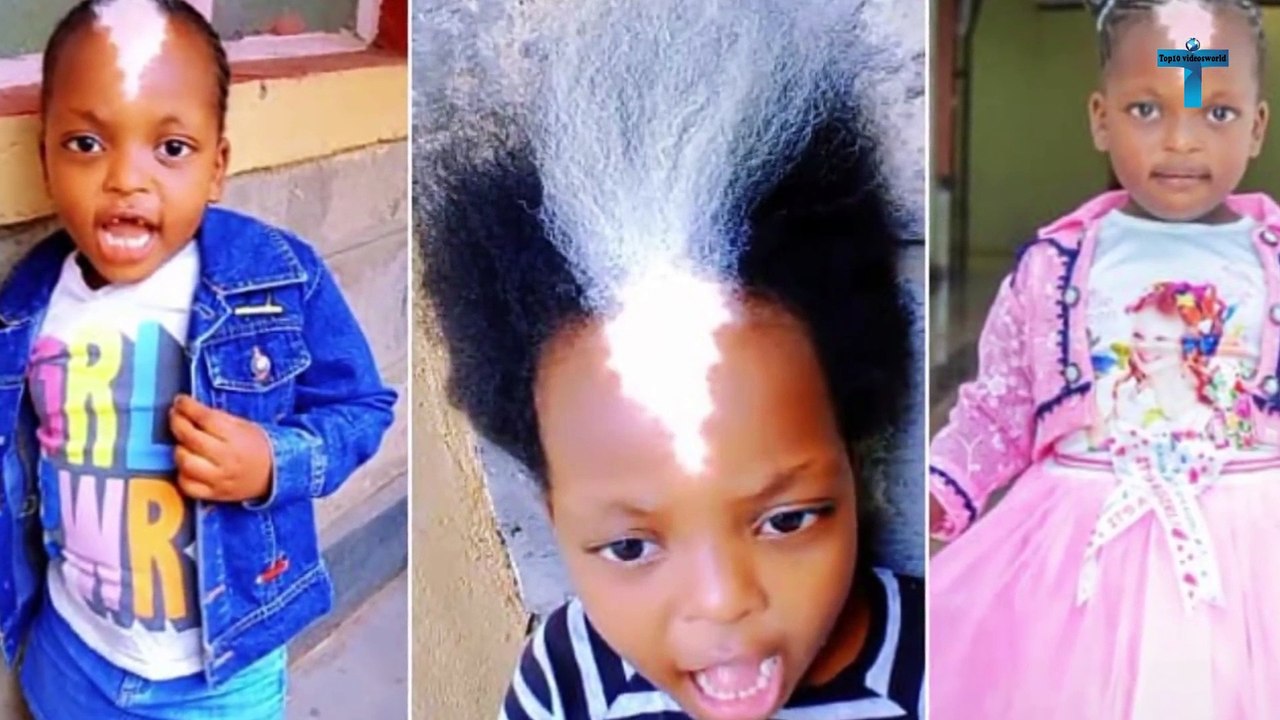 TOP 10 UNUSUAL BABIES YOU'VE NEVER SEEN IN THE WORLD! - video Dailymotion