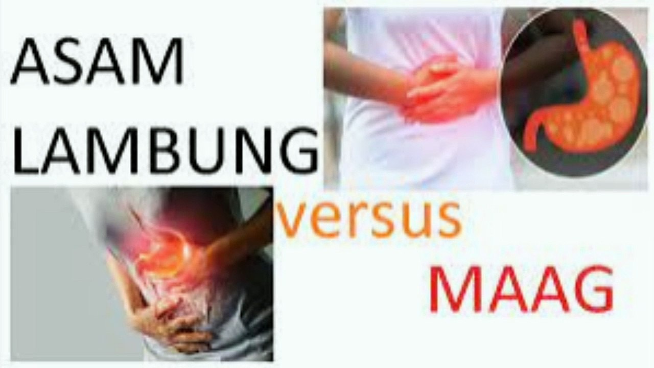 Inilah perbedaa dari penyakit Maag Vs GERD - Video Dailymotion