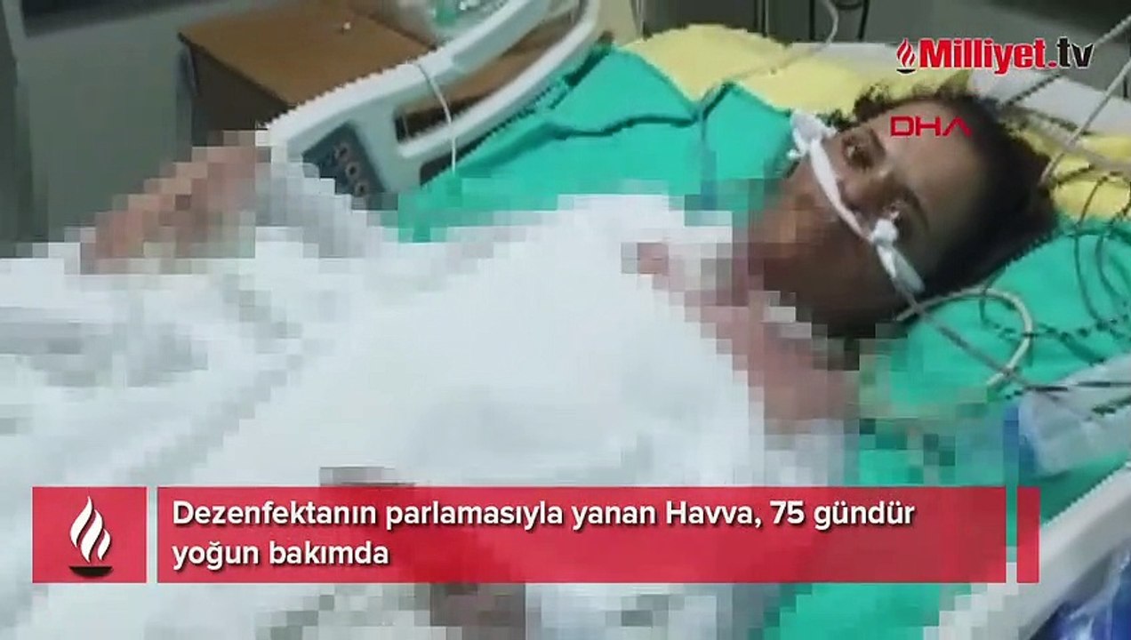 Dezenfektan 20 yaşındaki Havva'yı bu hale getirdi! 75 gündür yoğun ...