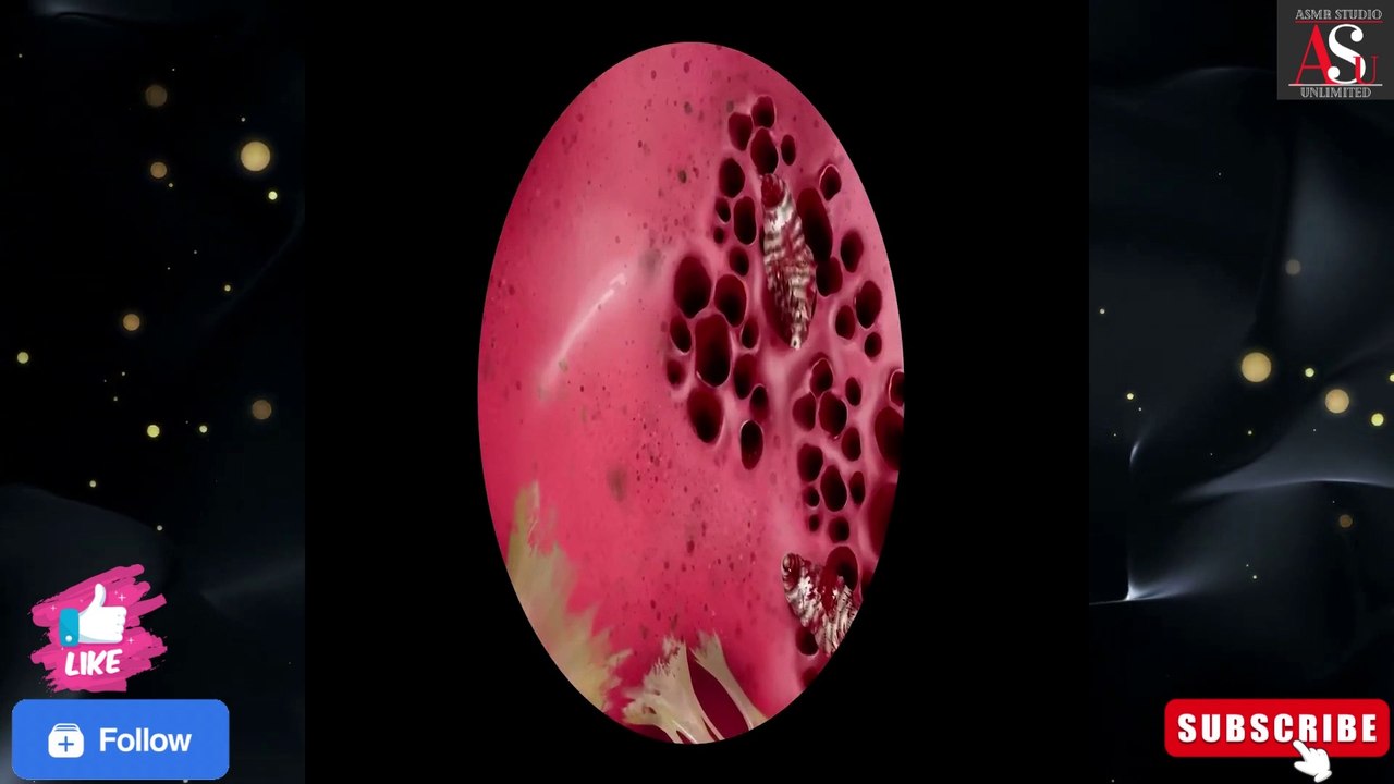 ASMR Maggots Removal|botfly maggot removal|maggot removal|maggot ...