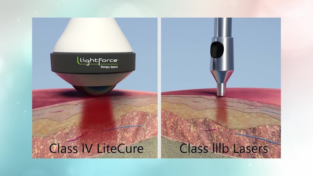 Tired of living in pain? Laser Pain Away™ announces LightForce® XLi 40 ...