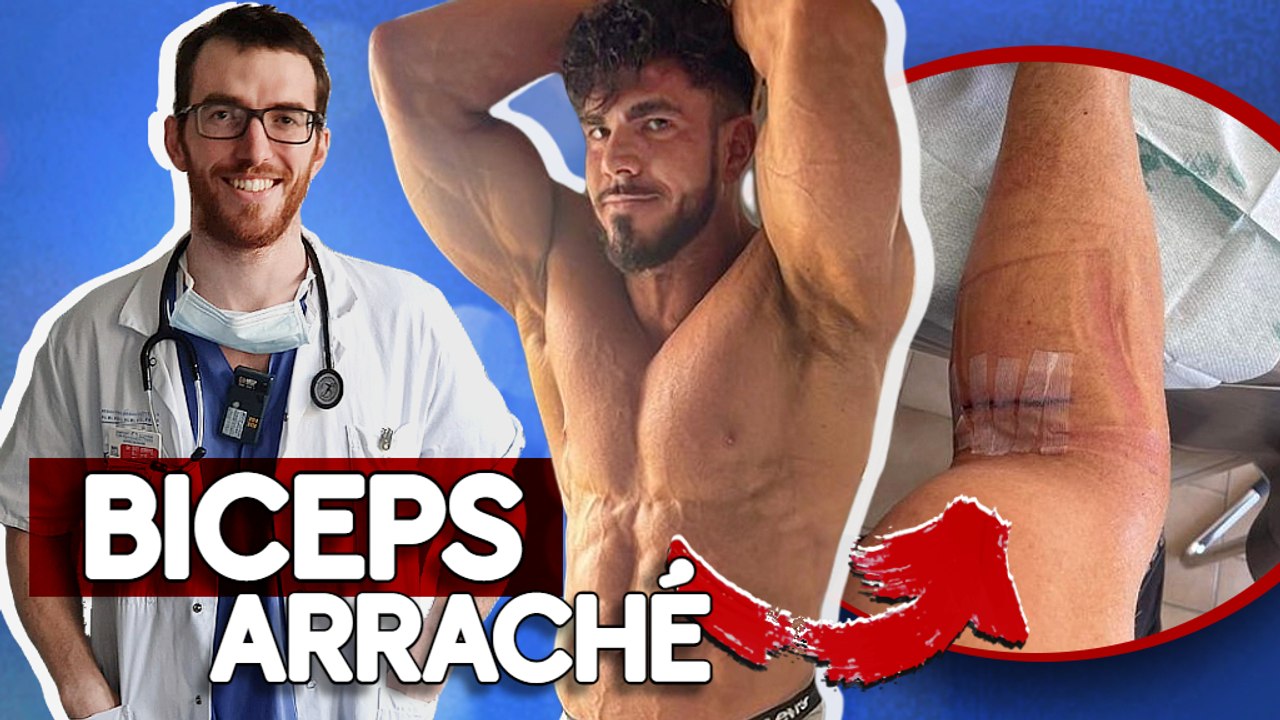 UN DOCTEUR RÉAGIT À LA DÉCHIRURE DU BICEPS DE DAVID CRUCIANI A FITNESS ...