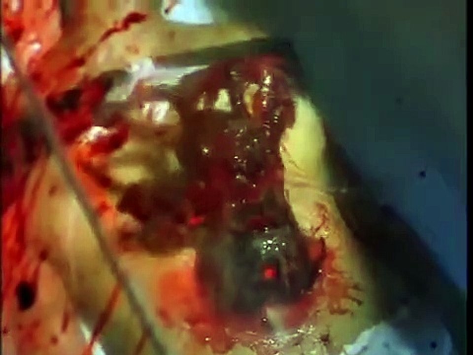 Spiders II: Breeding Ground | movie | 2001 | Official Trailer - video ...