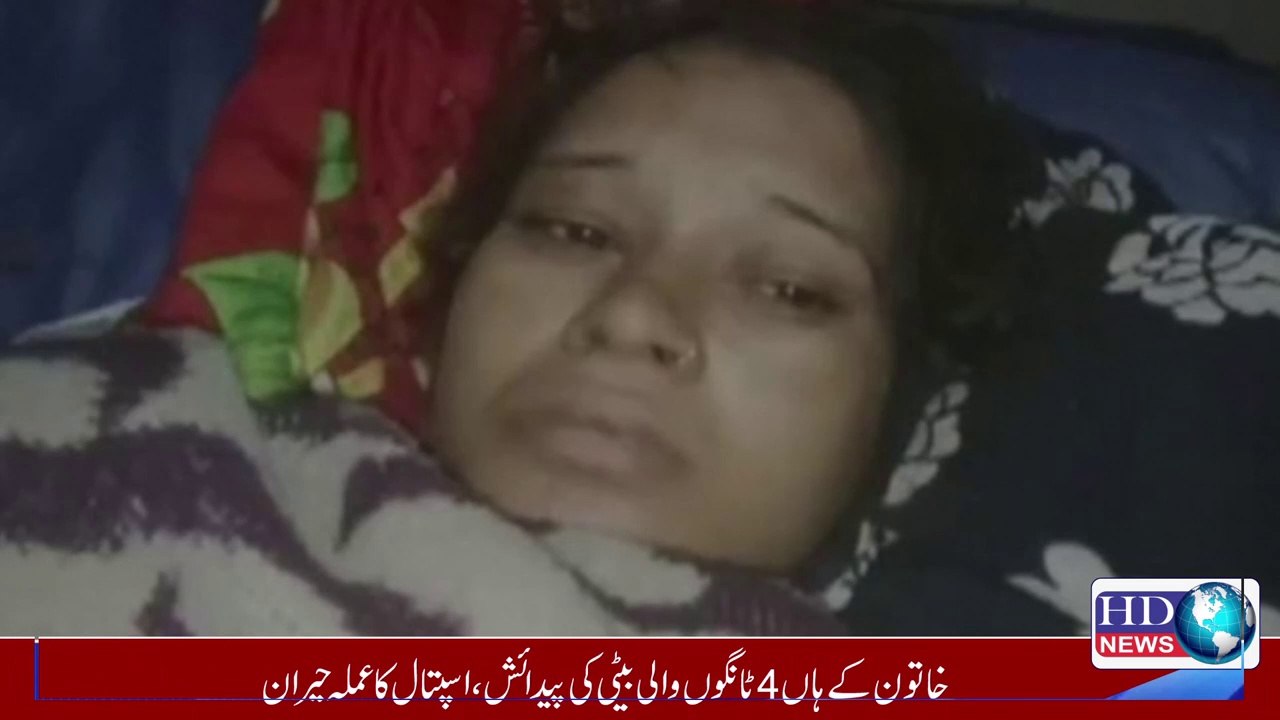 A woman gives birth to a daughter with 4 legs #hdnews #hdnewskharian ...